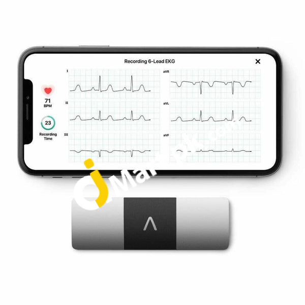 KardiaMobile® 6L The World's First Six-Lead Personal EKG, Lead Persona ...