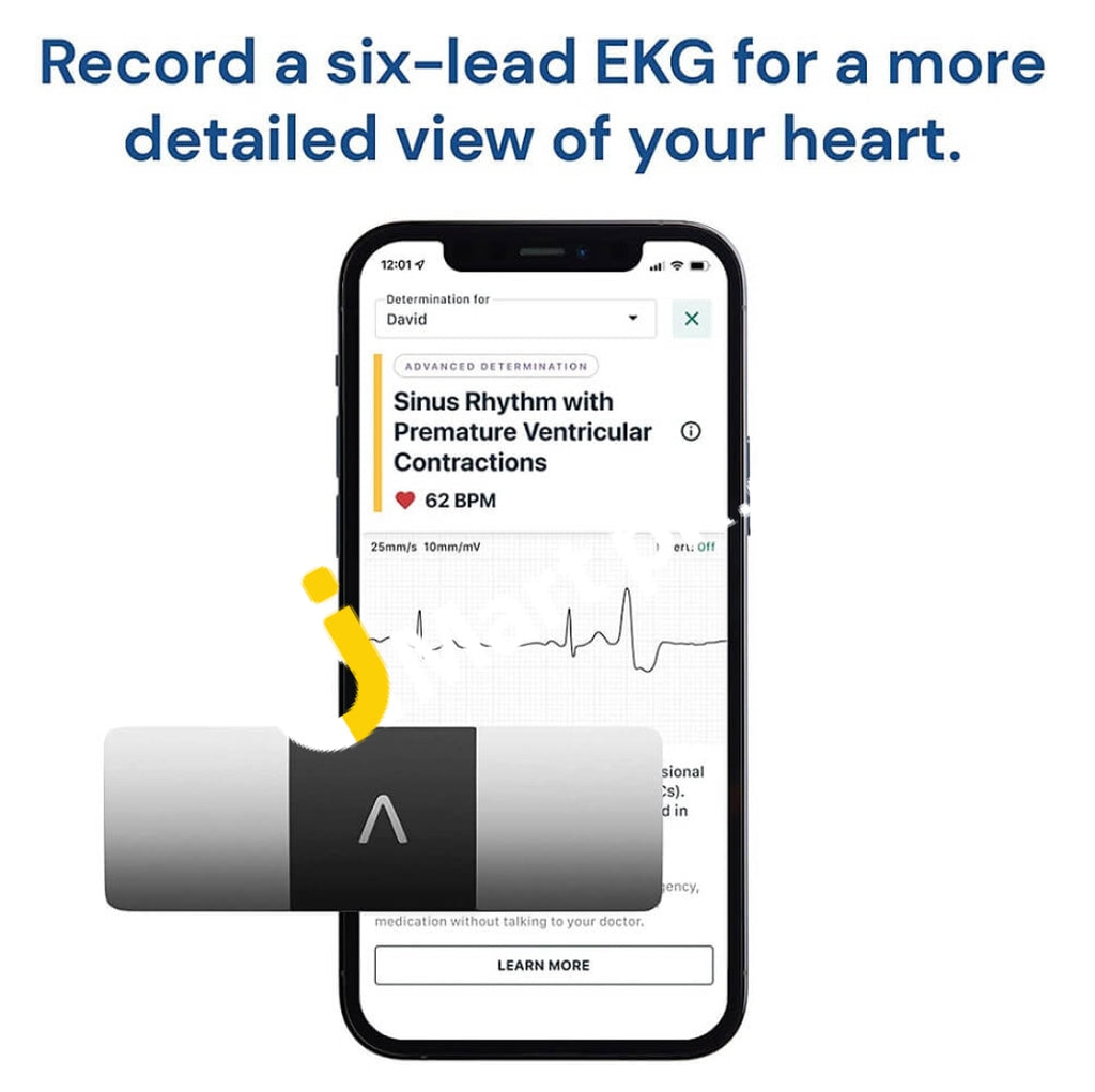 KardiaMobile 6-Lead Personal EKG Monitor, Six Views of The Heart, Dete ...