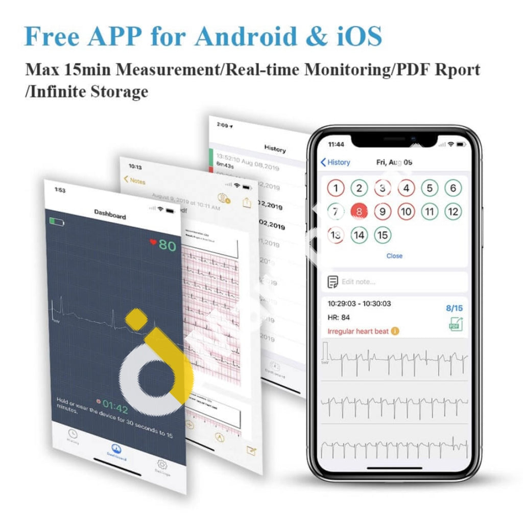Wellue Duoek™ Portable EKG Monitor / Wellue Heart Monitor, Bluetooth H ...