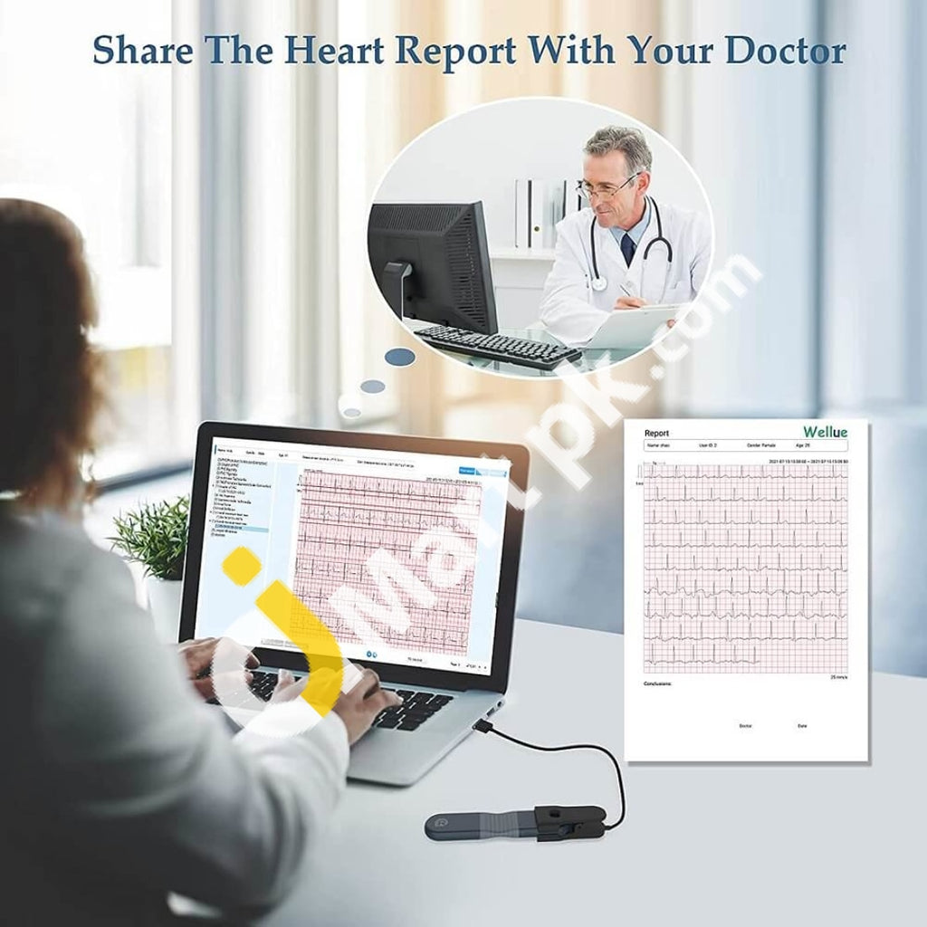 Wellue Viatom Heart Health Monitor, Professional Holter Recorder with ...